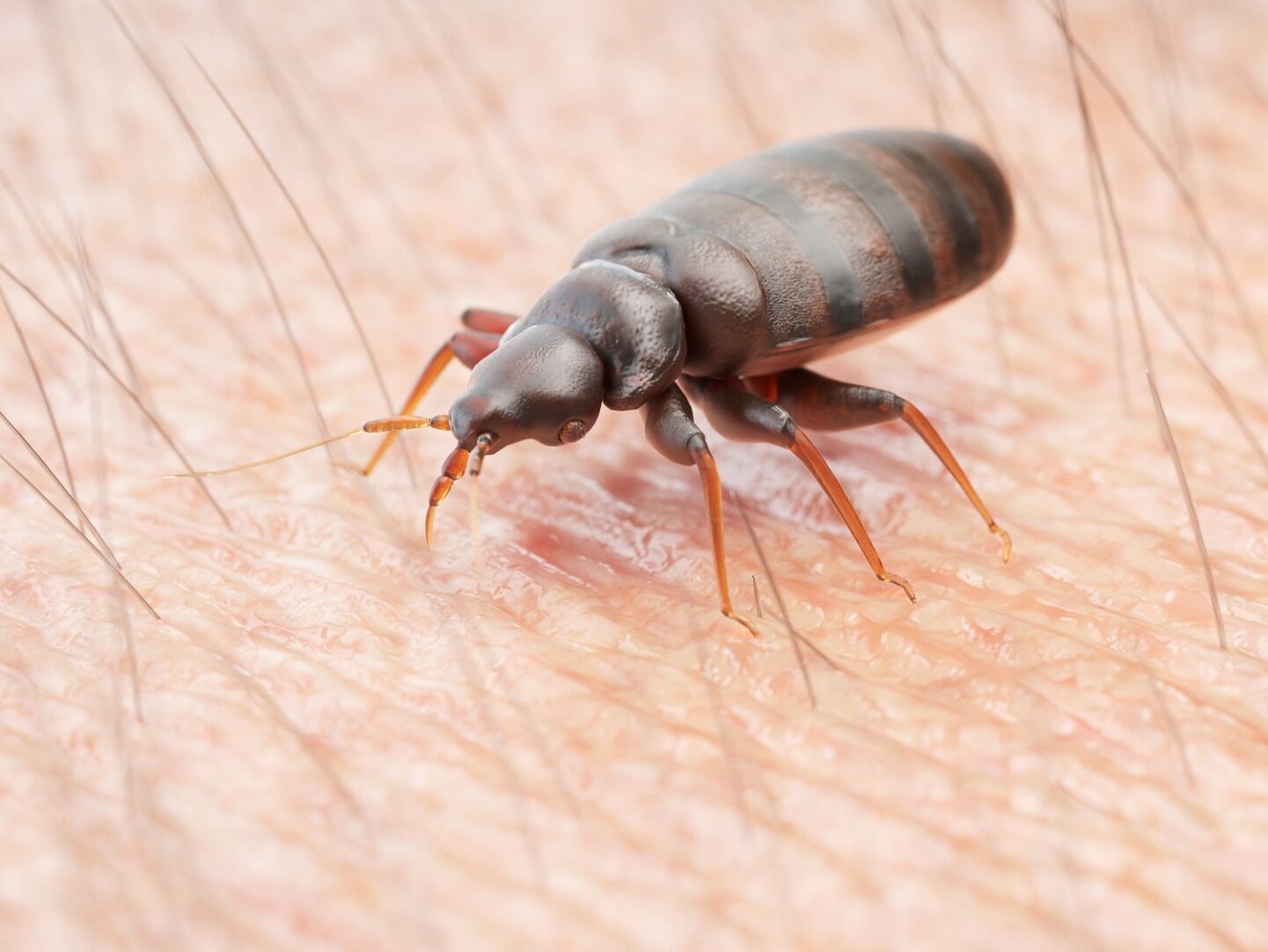 How Exterminators Get Rid of Bed Bugs (2025) | Today's Homeowner